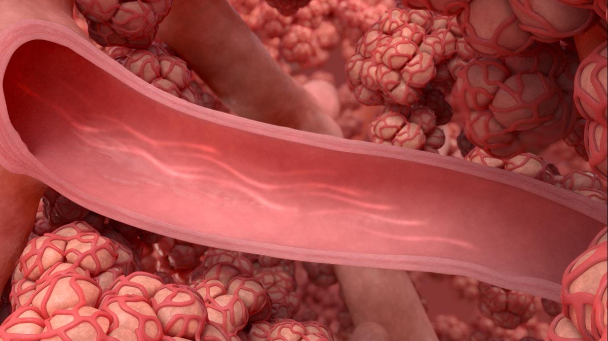 RheOx Bronchial Rheoplasty (GalaRheSolve) - Emphysema COPD Research Center